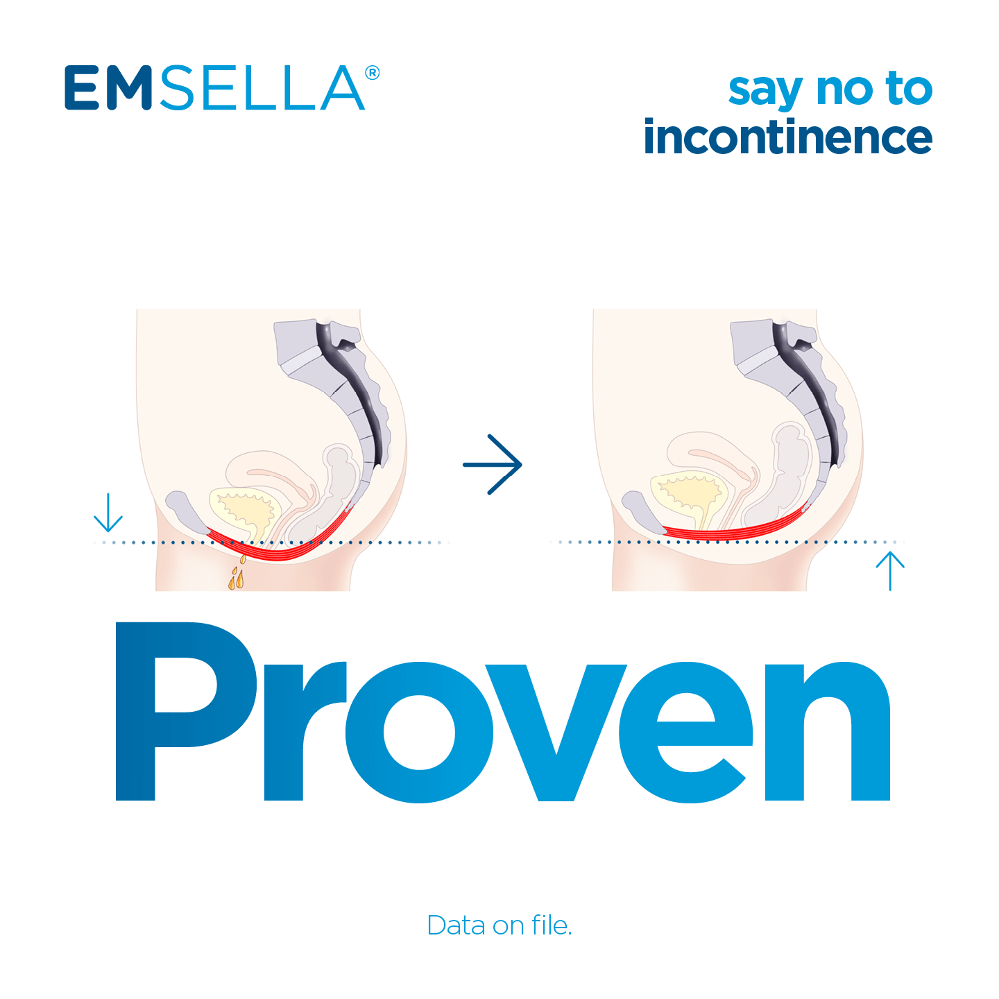 Pelvic Floor Dysfunction - Bare Beauty